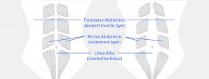 Abdominal Separation (Diastasis Recti) – Katy’s Fitness