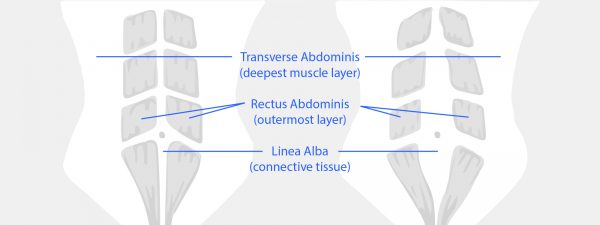 Abdominal Separation (Diastasis Recti) – Katy’s Fitness